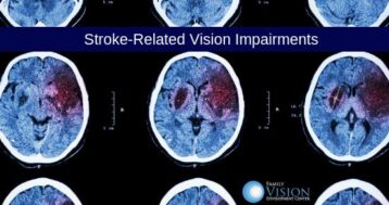 How Vision Therapy Can Treat Stroke-Related Vision Conditions - Family ...